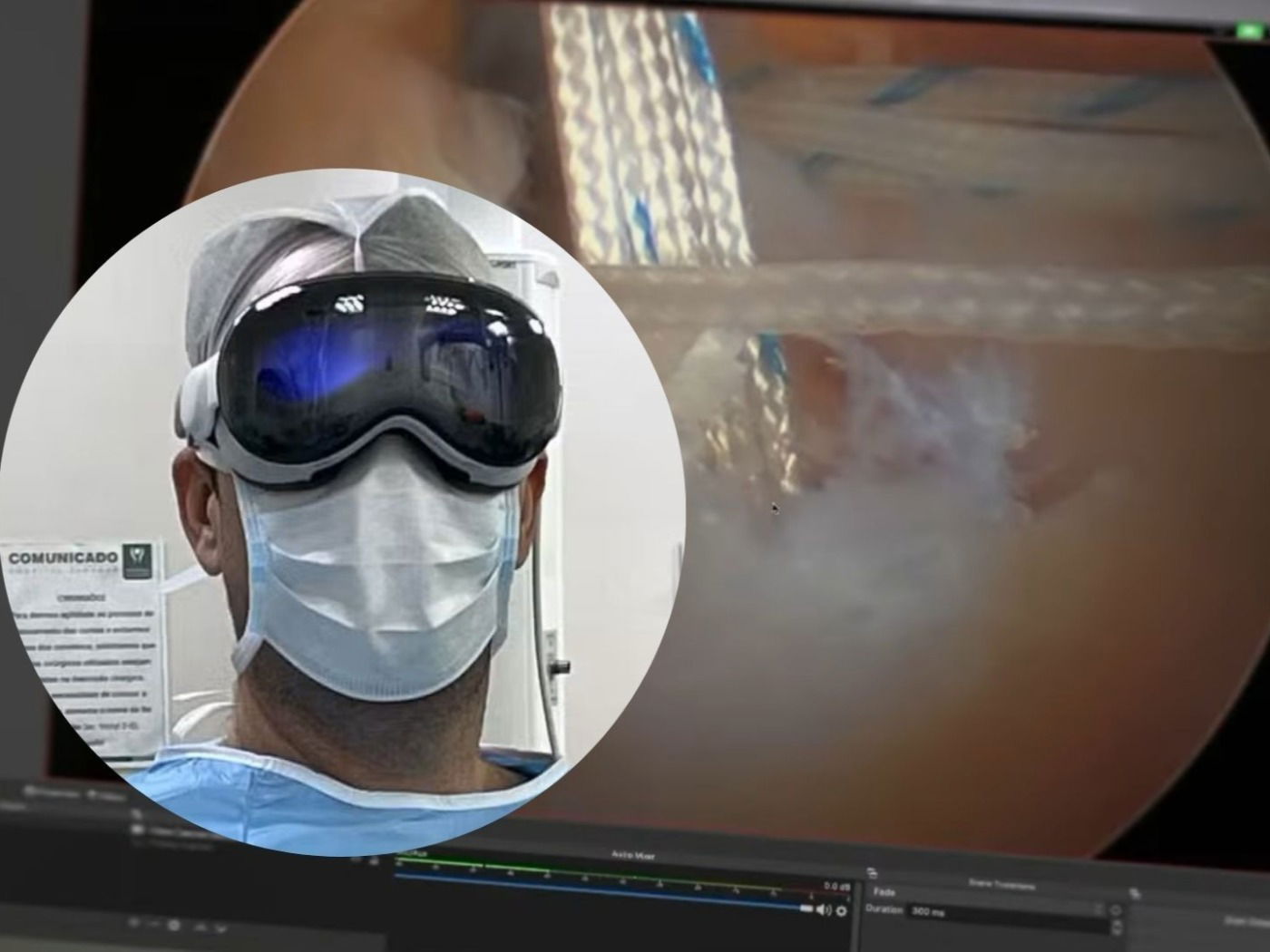Apple Vision Pro é usado por médico brasileiro em cirurgia no ombro ...