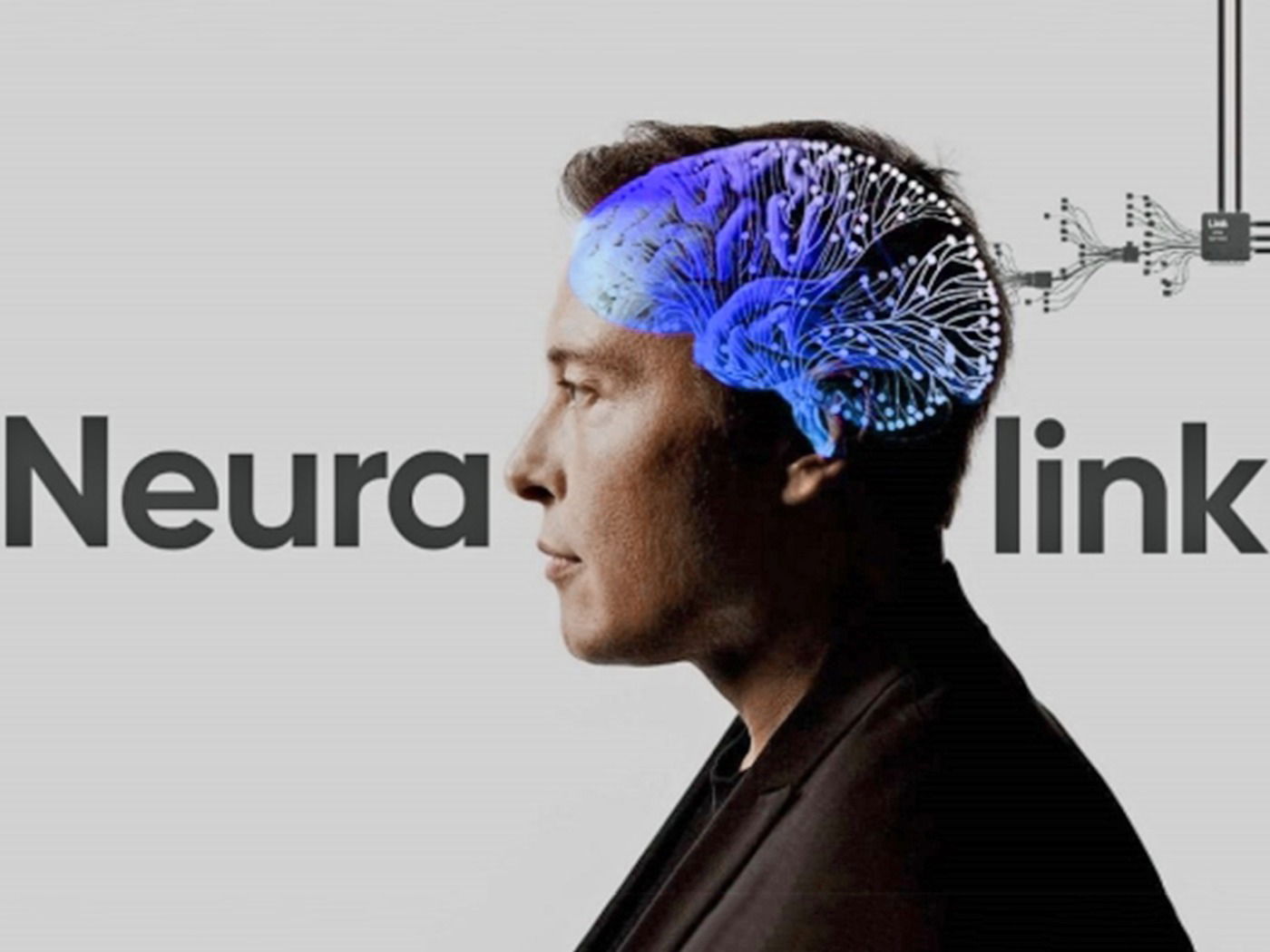 Paciente com chip Neuralink Joga Counter-Strike 2 e desenvolve projetos ...